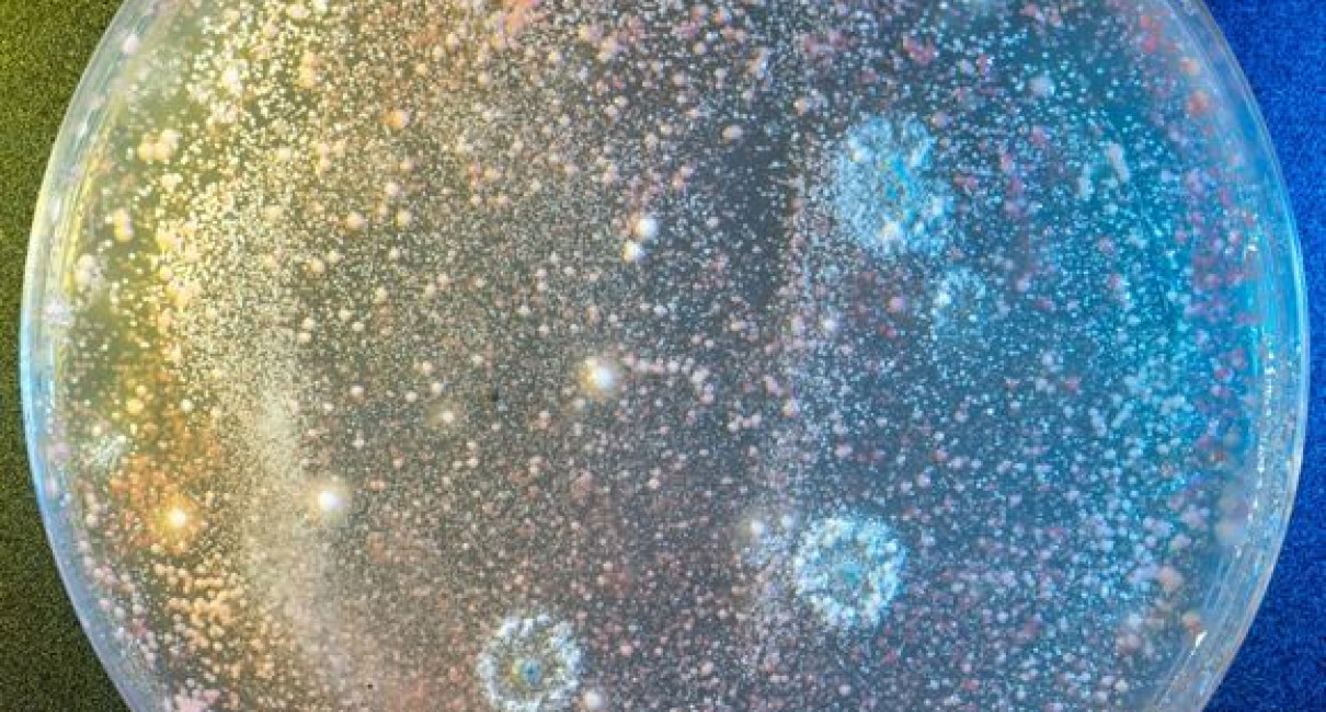 Plant-Microbes Interactions | School of Plant Sciences and Food ...