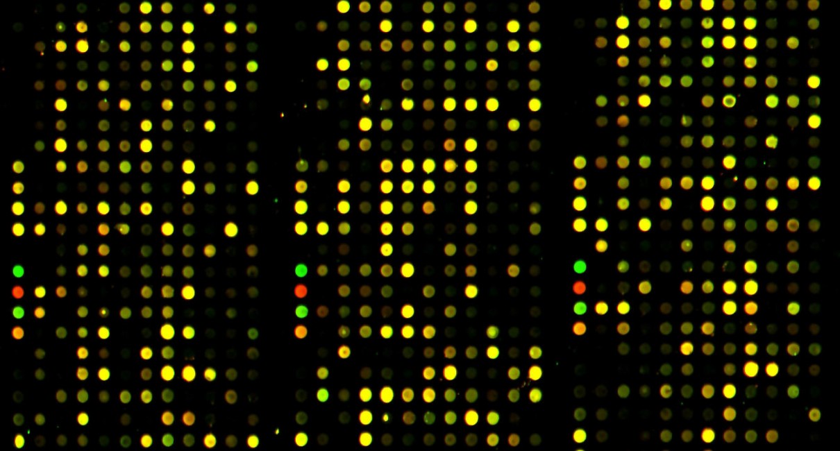 Microarray | TAU Bioinformatics Unit | Tel Aviv University