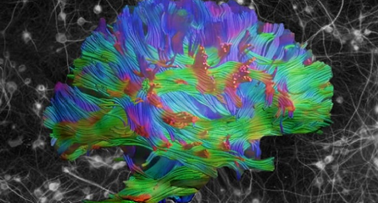 Neurobiology and Behavioral Neuroscience | The George S. Wise Faculty ...