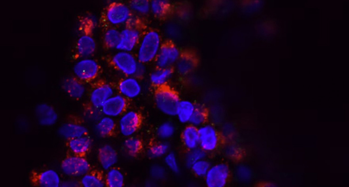 Special Seminar - Prof. Iris Fried | The George S. Wise Faculty of Life ...